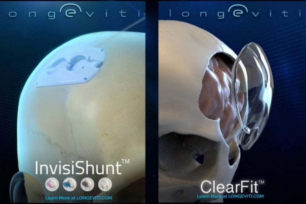 Longeviti Building ‘Space Shuttles’ to Bridge Neurosurgery, Plastic ...