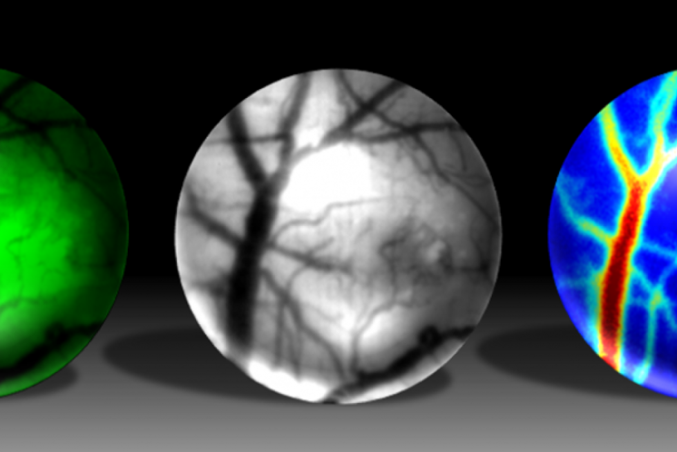 Mini Microscope is the New GoPro for Studies of Brain Disease in Living ...