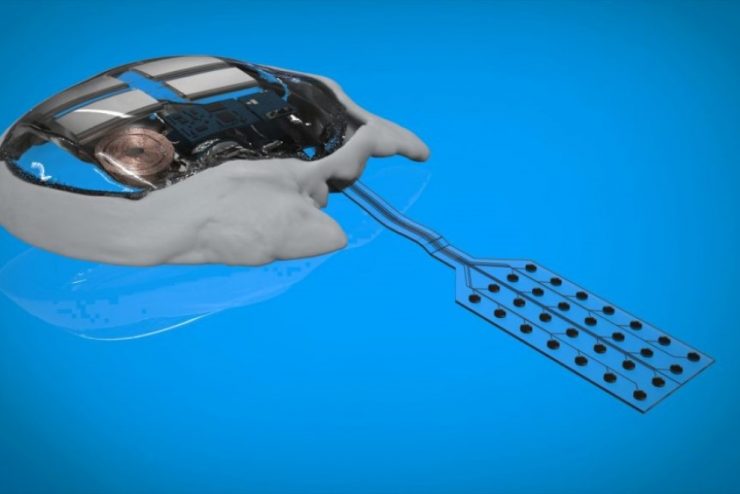 Longeviti Wants to Help Neurosurgery Patients be Whole Again - Johns ...