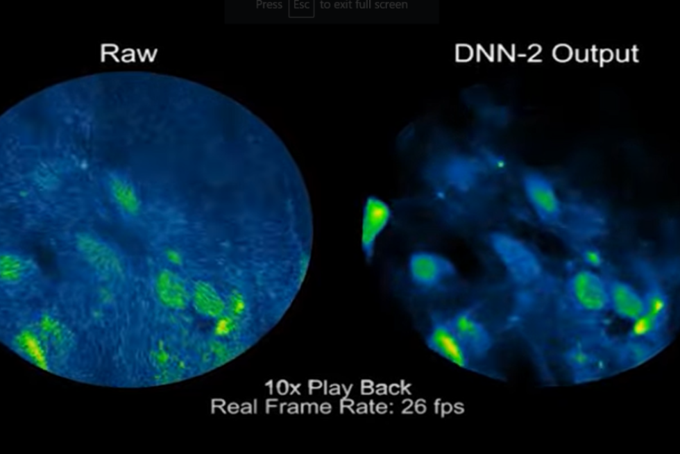 From Blurry to Bright: AI Tech Helps Researchers Peer into the Brains ...