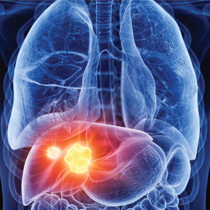 Homepage - Johns Hopkins Technology Ventures