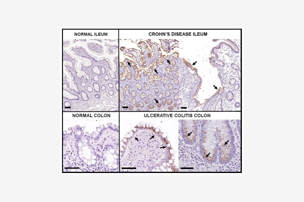 Johns Hopkins Researchers Develop Gut-Restricted Drug to Treat IBD ... Johns Hopkins Researchers Develop Gut-Restricted Drug to Treat IBD ...