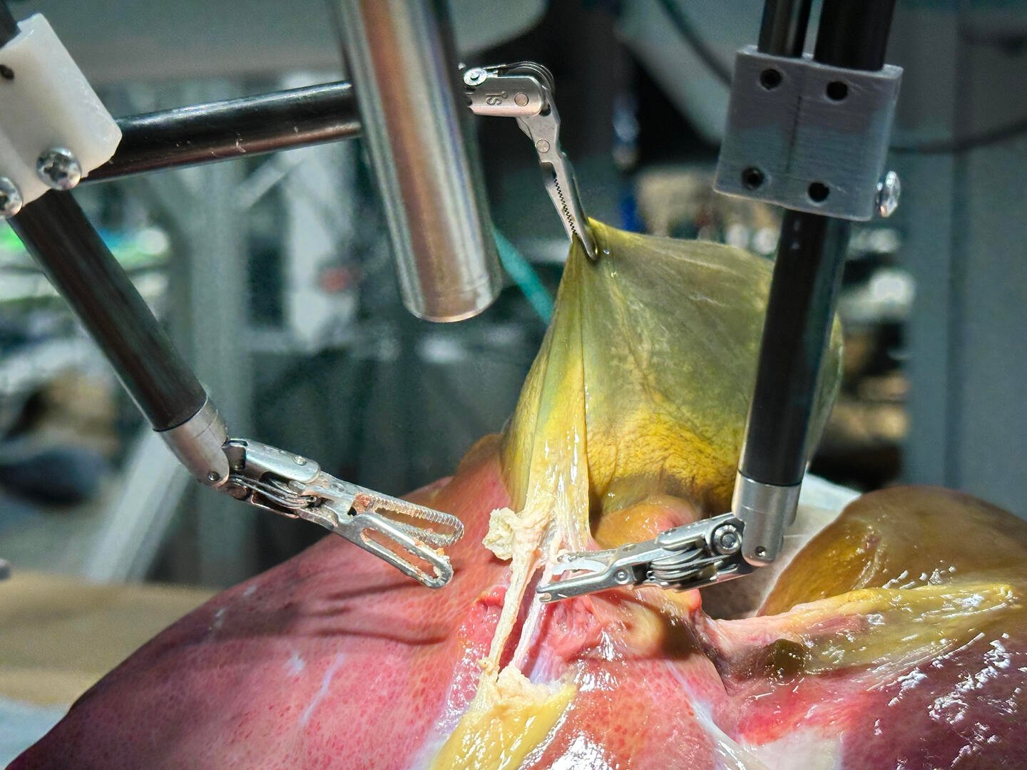 Robot Performs First Realistic Surgery Without Human Help - Johns ...